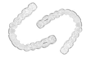 Orthodontic Retainers Bethesda MD | Kelly Orthodontics